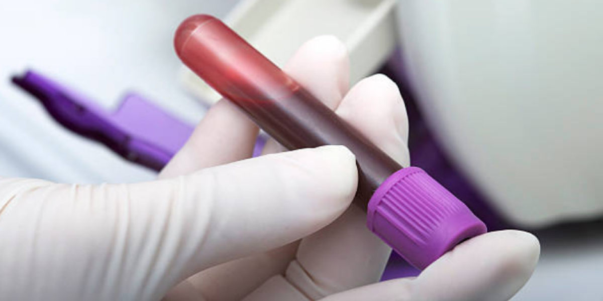 The Pre-Marriage Blood Test In America Is Now Gone | Mises Institute