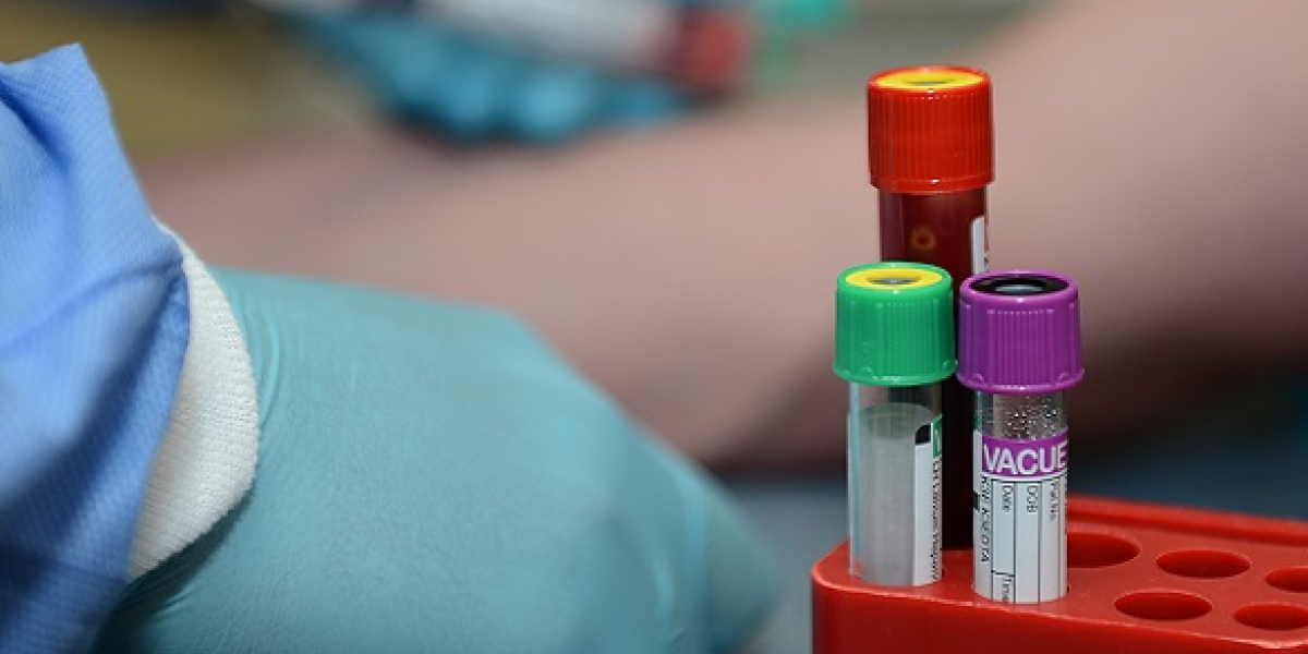 How the CDC Prevented Fast and Accurate Testing for COVID-19 | Mises ...